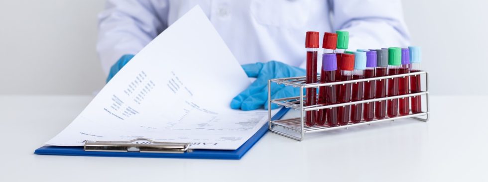 Discover what are clinical trials? Understanding 4 phases, examples ...